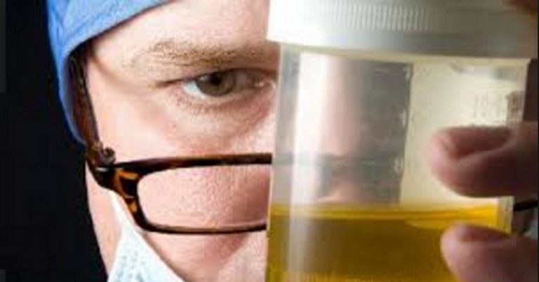 El color de tu orina puede revelar tu estado de salud | La Verdad sin ...